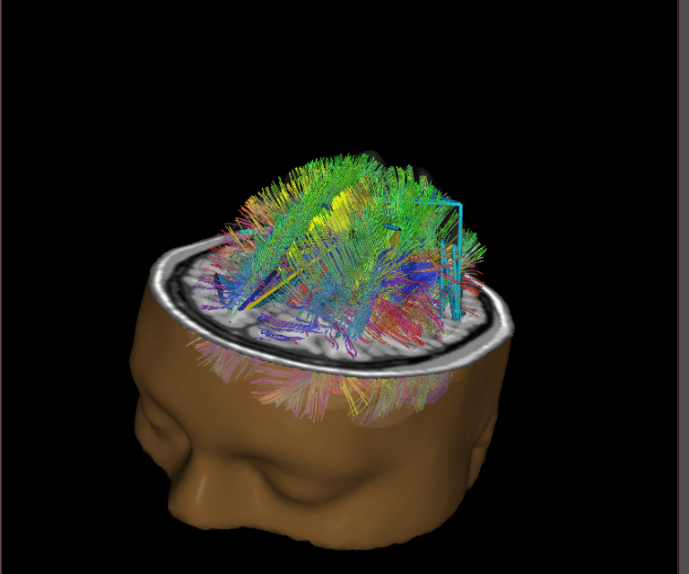 The Truth About Concussions and CTE: Insights from New Research - Dr ...